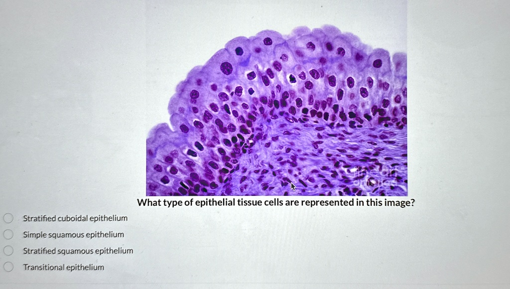 stratified cuboidal epithelium simple squamous epithelium stratified ...