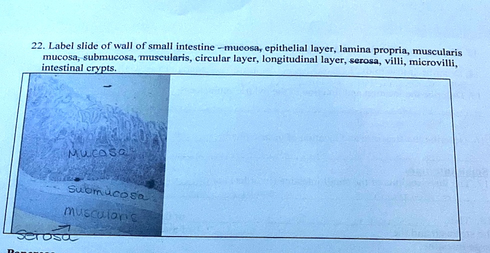 22. Label slide of wall of small intestine –mucosa, epithelial layer ...