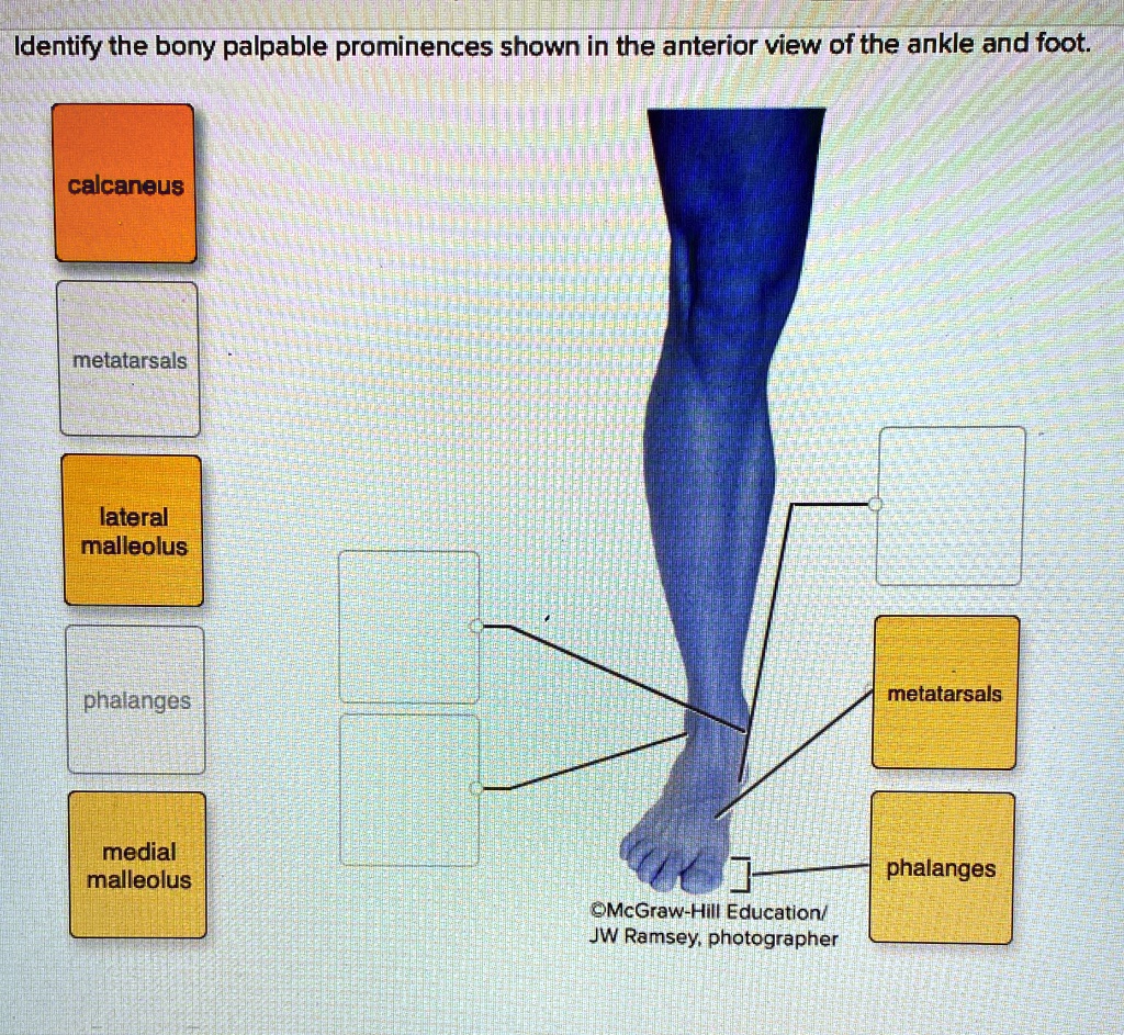 Identify the bony palpable prominences shown in the anterior view of ...