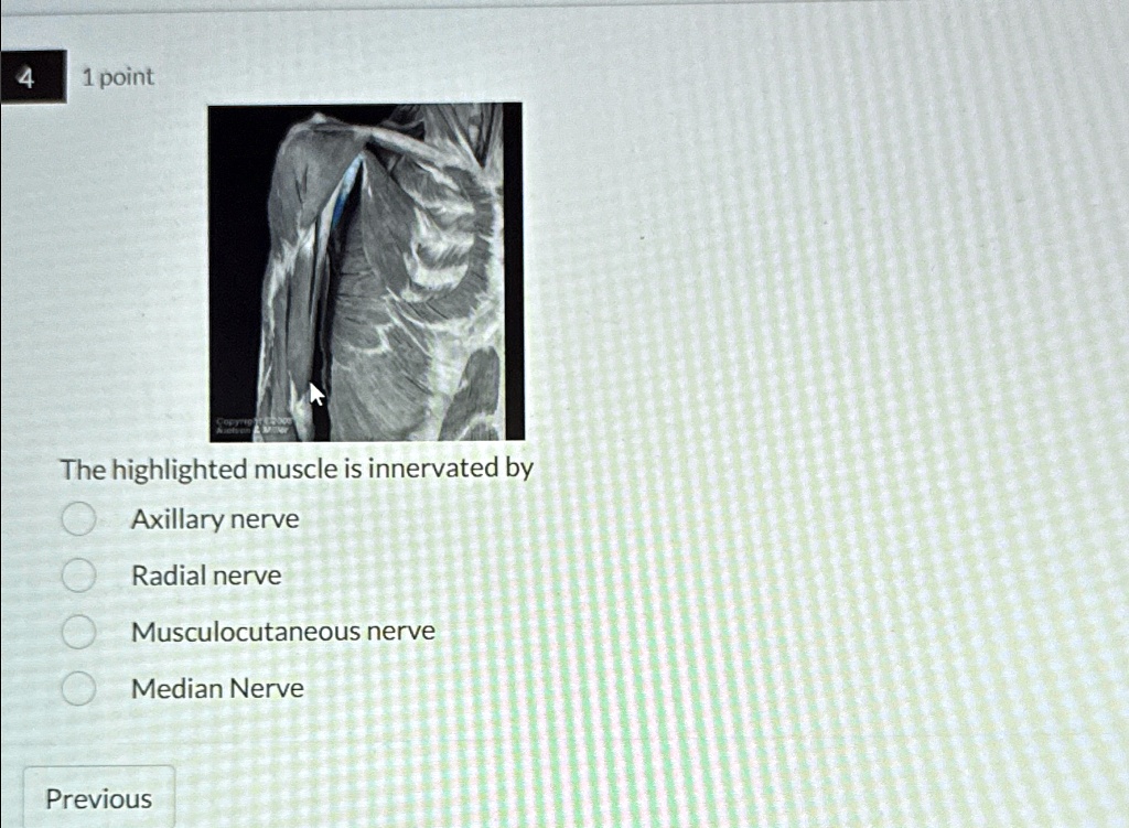 SOLVED: 41 point The highlighted muscle is innervated by Axillary nerve ...