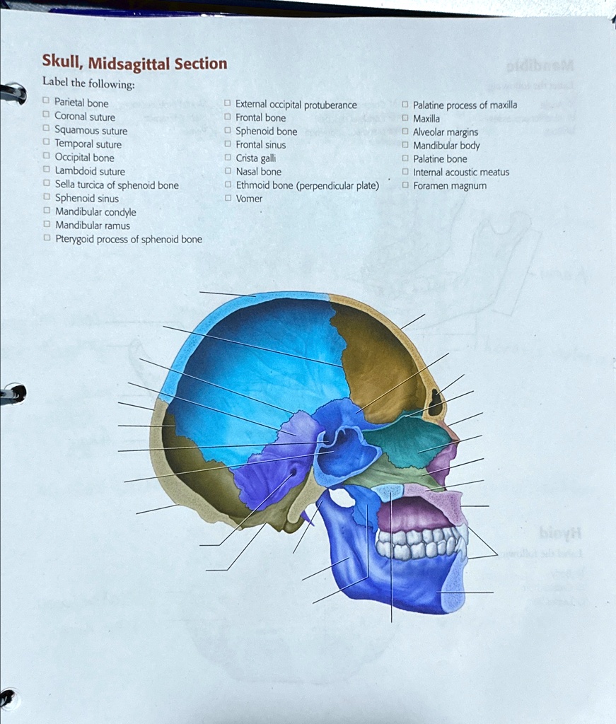 Skull, Midsagittal Section Label the following: Parietal bone Coronal suture Squamous suture ...