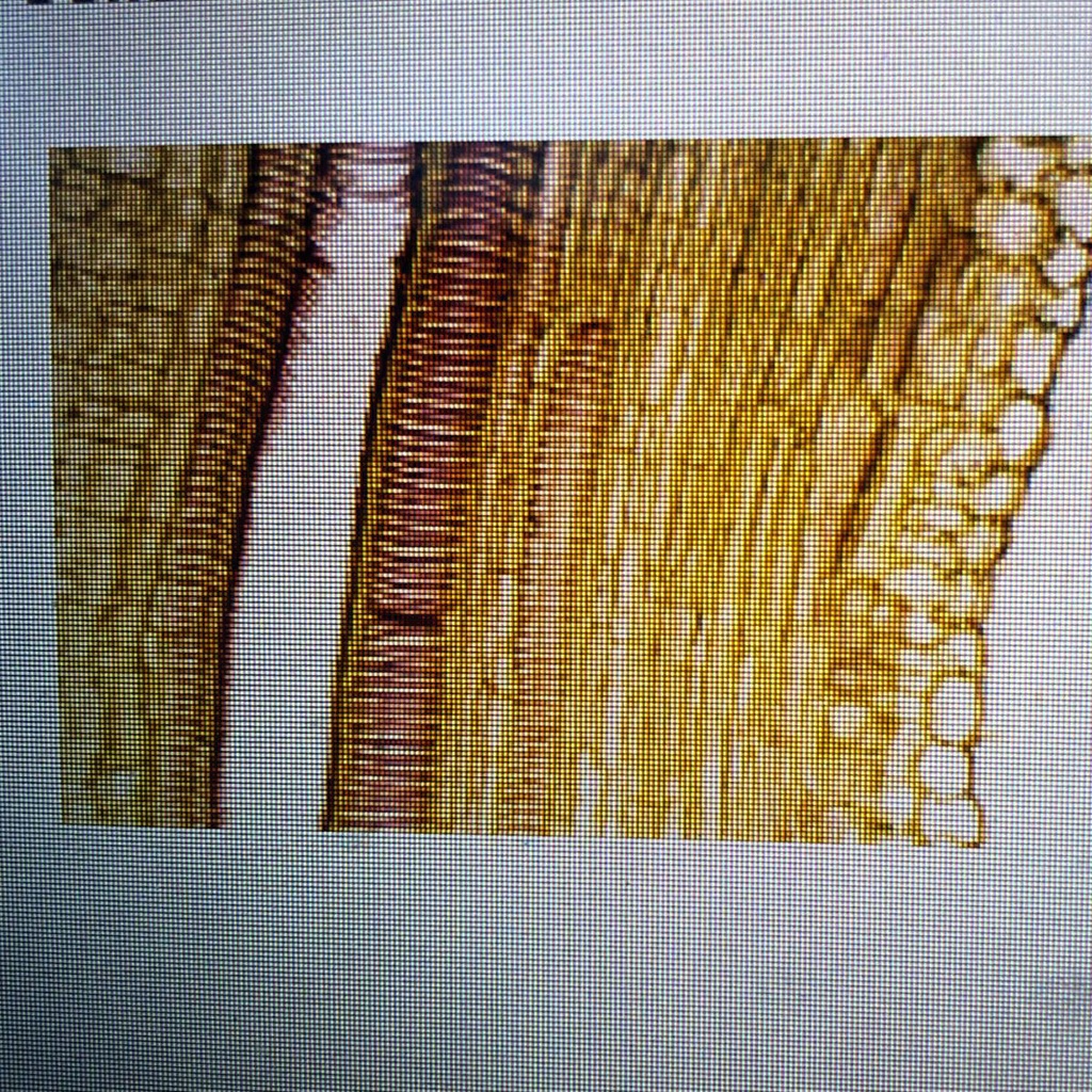 SOLVED: 'The cells in this part of a plant form long, vertical tubes ...