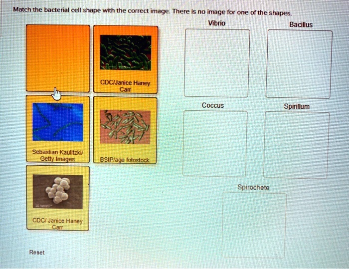 SOLVED: Match the bacterial cell shape with the correct image. There is ...