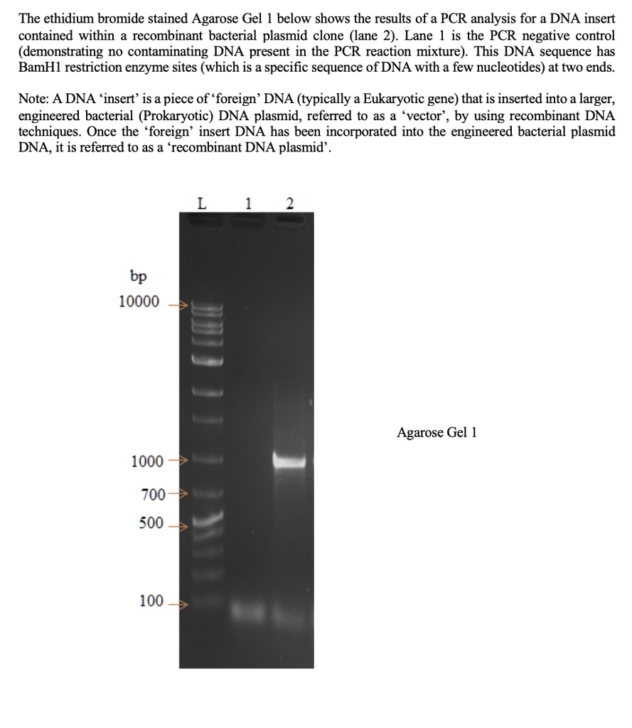 The ethidium bromide stained Agarose Gel 1 below shows the results of a ...