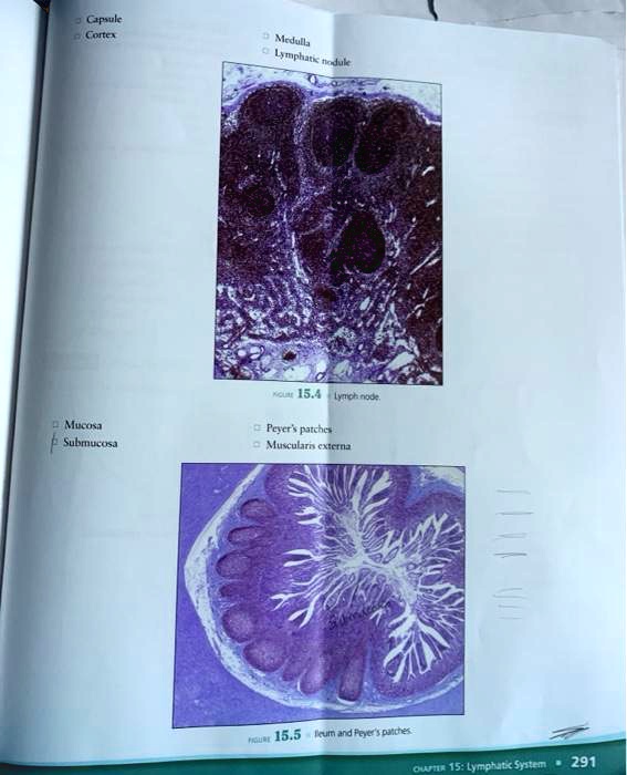 Capsule Cortex Medulla Lymphatic nodule Mucosa Submucosa FIGURE 15.4 ...