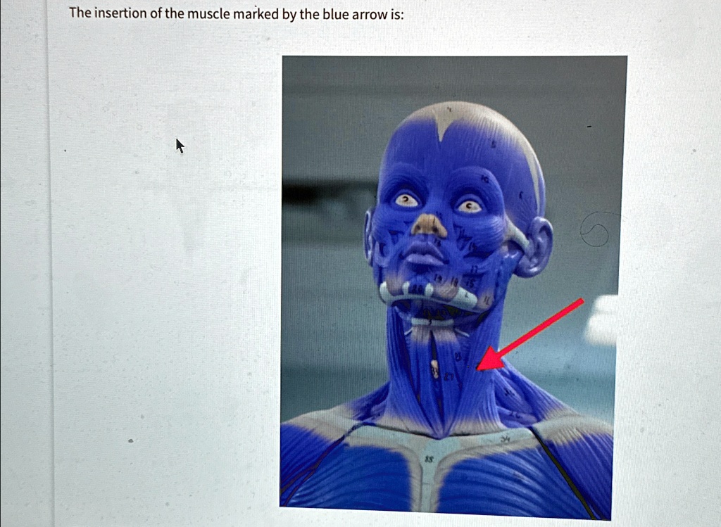 The insertion of the muscle marked by the blue arrow is: A: sternum B ...