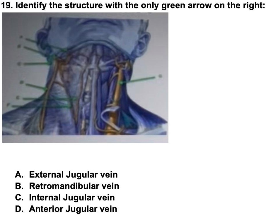 19. Identify the structure with the only green arrow on the right: A ...