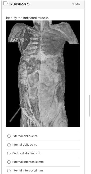 Identify the indicated muscle. External oblique muscle Internal oblique ...
