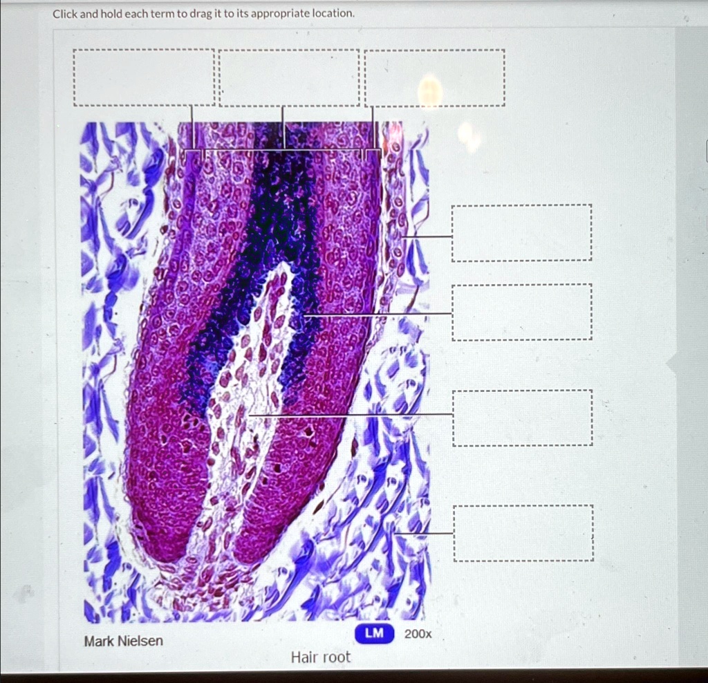 Click and hold each term to drag it to its appropriate location. LM ...