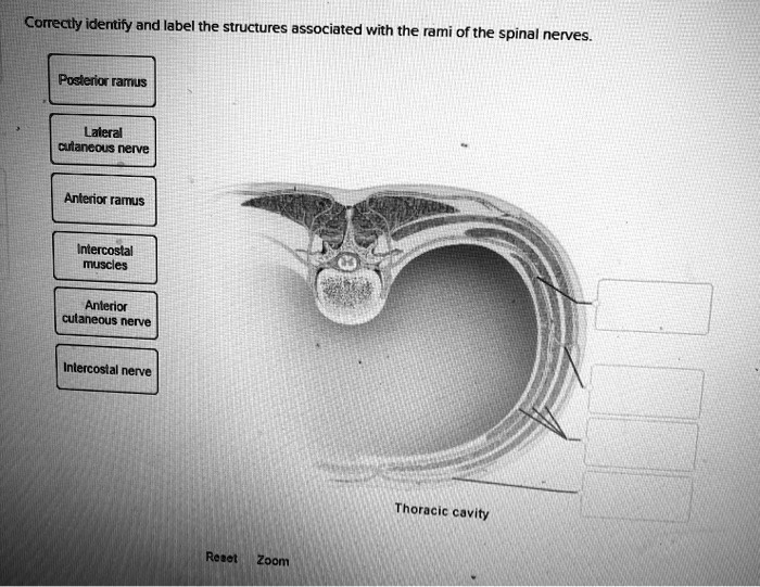 Correctly identify and label the structures associated with the rami of ...