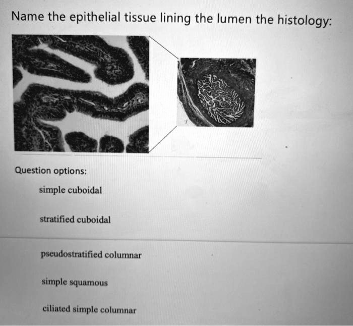 name the epithelial tissue lining the lumen the histology question ...