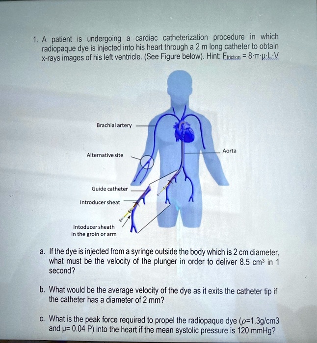 A patient is undergoing a cardiac catheterization procedure in which ...