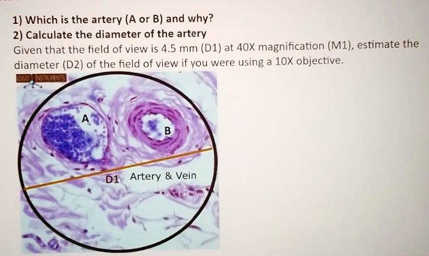 SOLVED: 1) Which is the artery (A or B) and why? 2) Calculate the ...