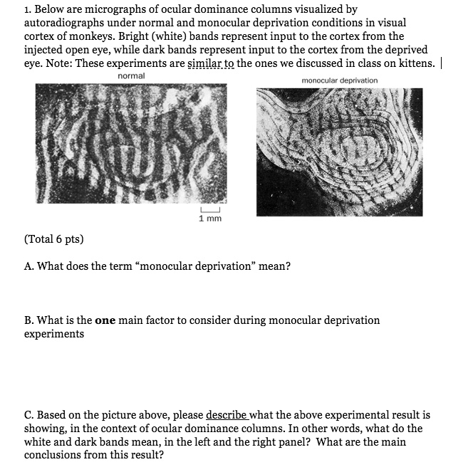 below are micrographs of ocular dominance columns visualized by ...