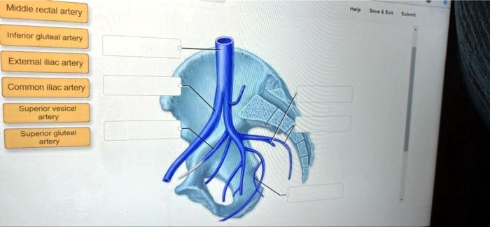 Middle rectal artery Inferior gluteal artery External iliac artery ...