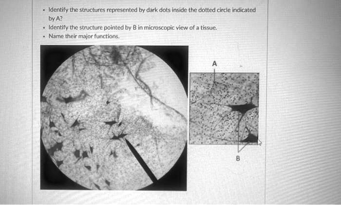SOLVED: Identify the structures represented by dark dots inside the dotted circle indicated by A ...