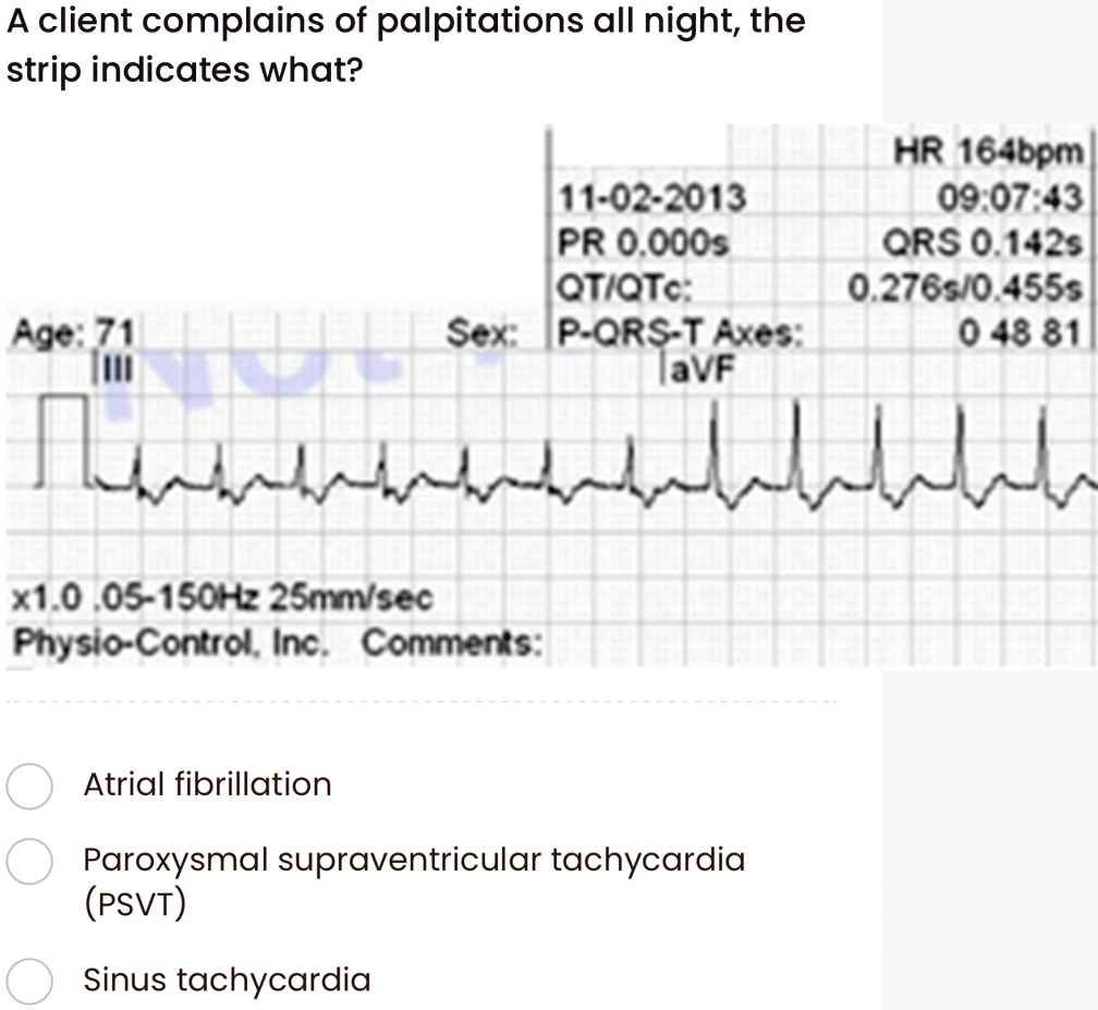 a client complains of palpitations all night the strip indicates what ...