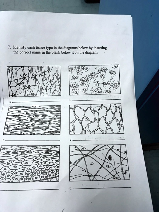 7. Identify each tissue type in the diagrams below by inserting the ...