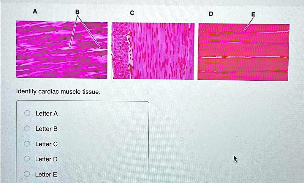 SOLVED: Identify cardiac muscle tissue. Letter A Letter B Letter C ...