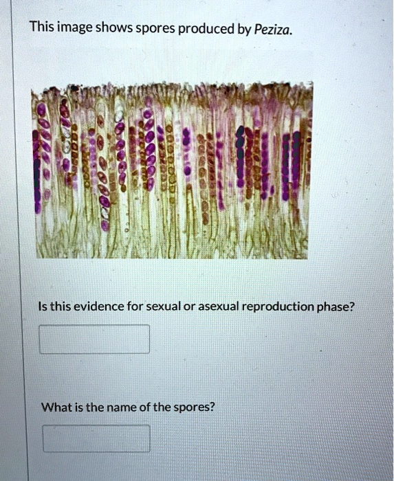 SOLVED: This image shows spores produced by Peziza. Is this evidence ...