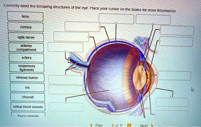 SOLVED: Correctly label the following structures of the eye: Place your ...