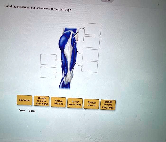 SOLVED: Label the structures in a lateral view of the right thigh ...