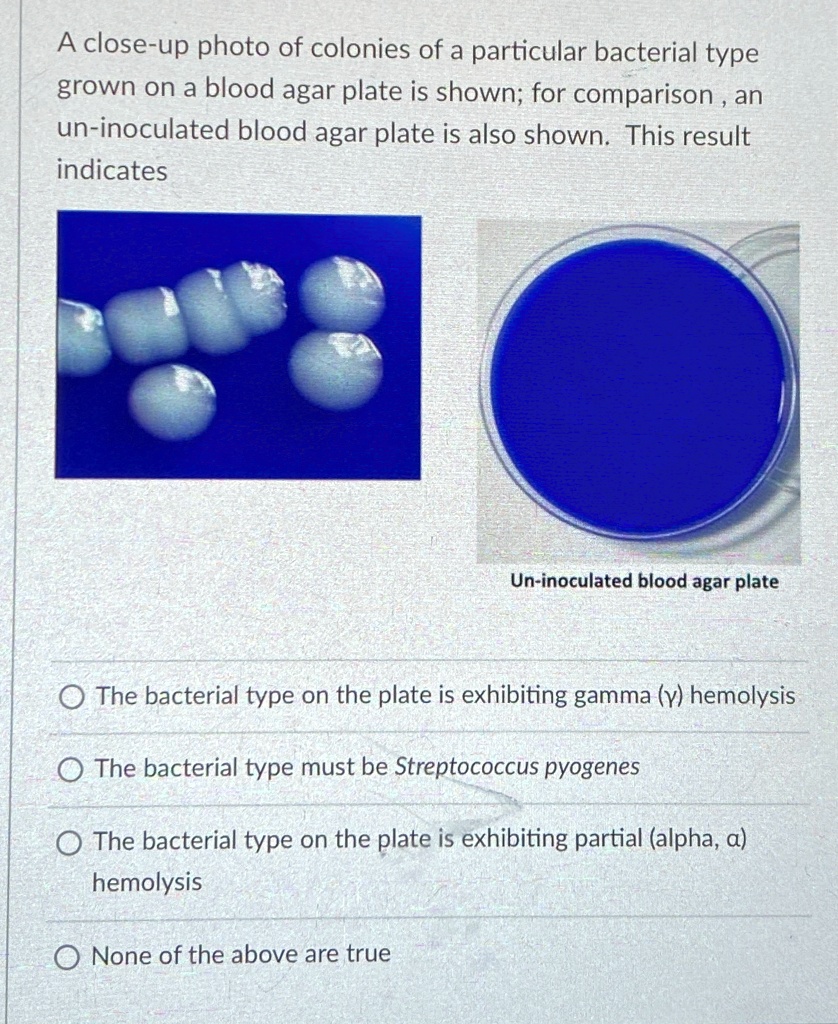 SOLVED: A close-up photo of colonies of a particular bacterial type ...