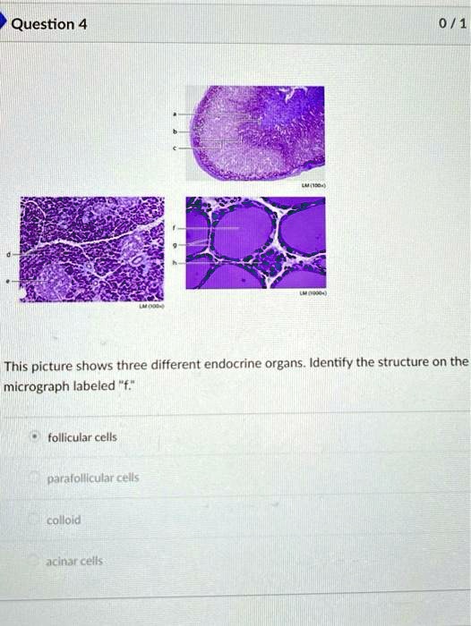 SOLVED: This picture shows three different endocrine organs. Identify ...