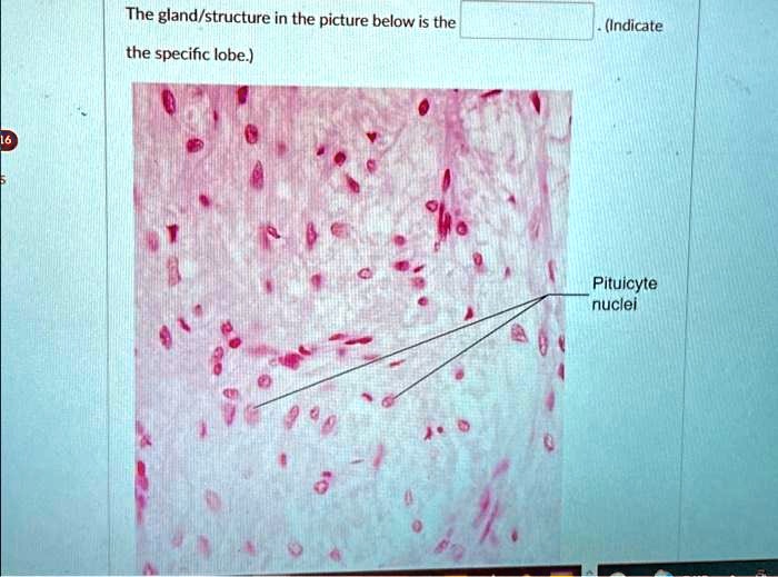 16 The gland/structure in the picture below is the . (Indicate the ...