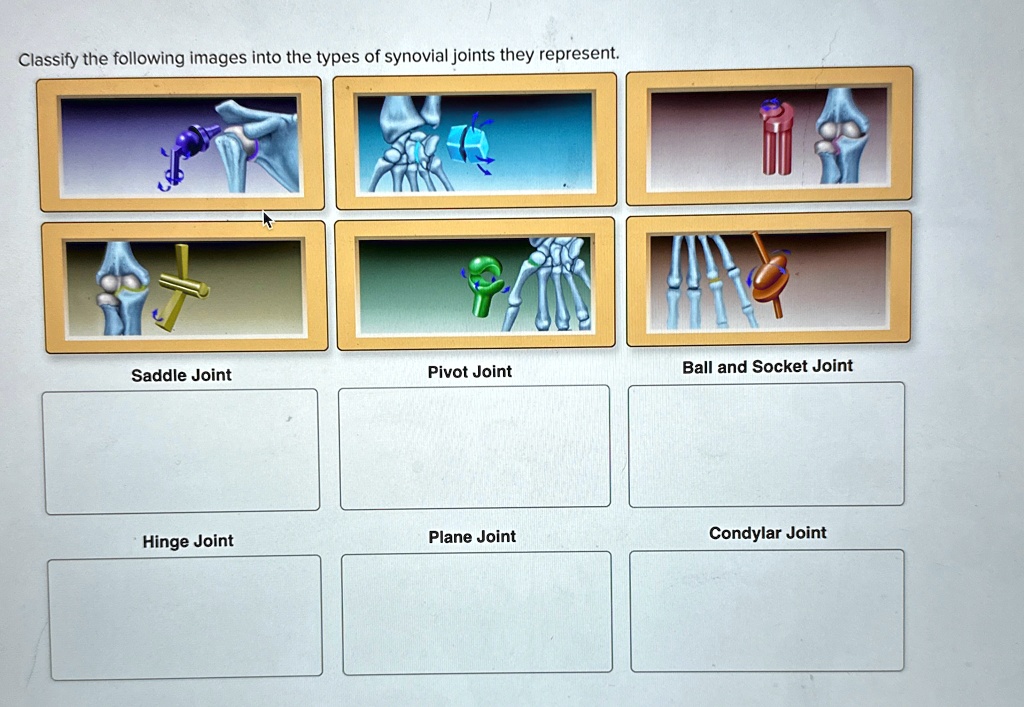 Classify the following images into the types of synovial joints they ...