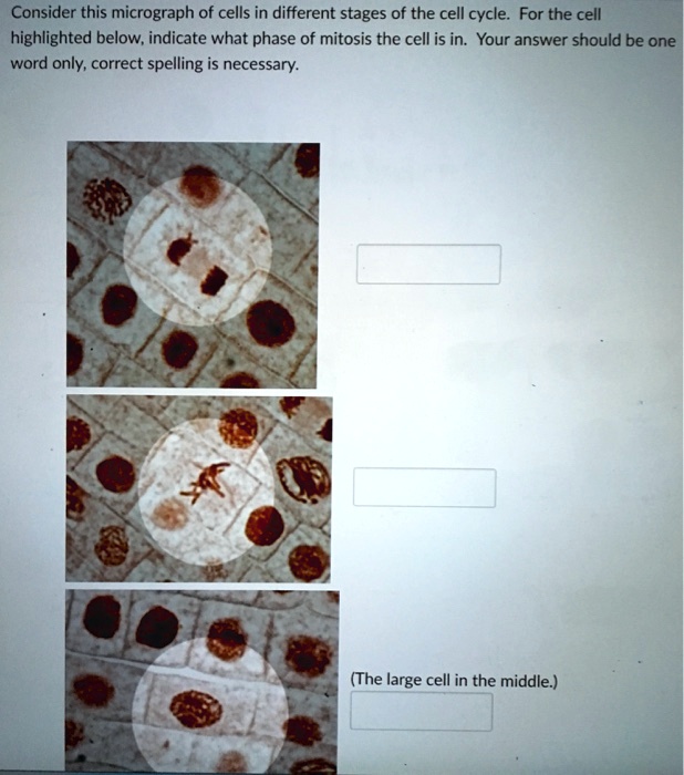SOLVED: Consider this micrograph of cells in different stages of the ...
