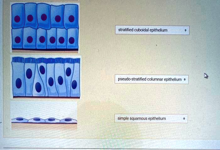 SOLVED:stratified cuboidal epithelium pseudo stratified columnar ...