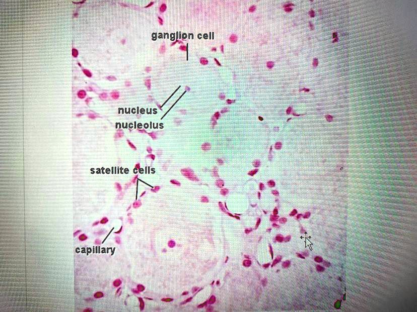 SOLVED: Observe the dorsal root ganglion magnified on the microscope ...