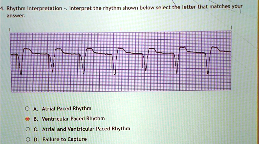 rhythm interpretation interpret the rhythm shown below select the ...