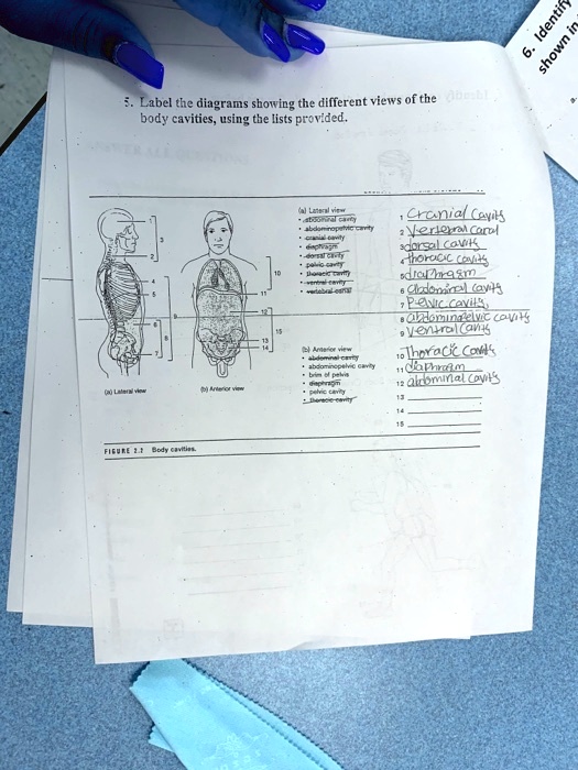 SOLVED: Label the diagrams showing the different views of the body ...