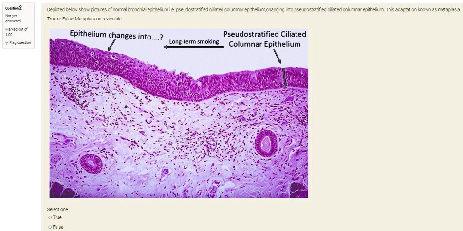 Question 2 Not yet answered Marked out of 1.00 Flag question Depicted ...