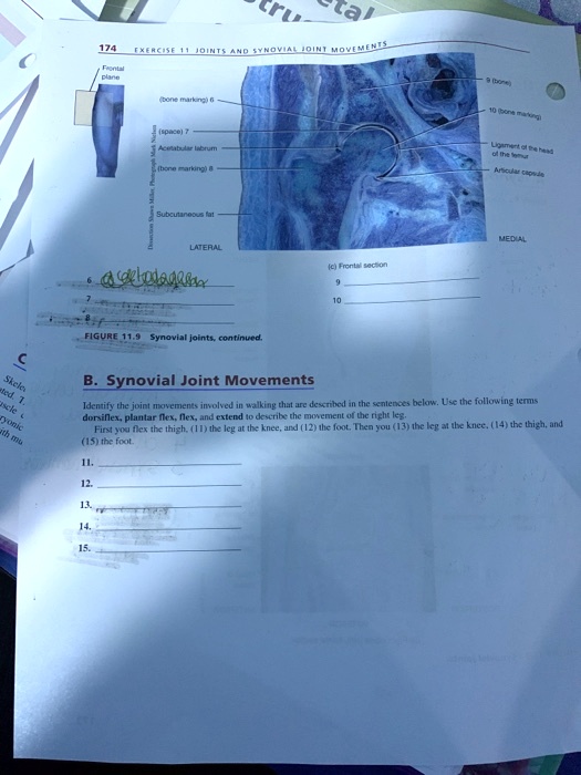 SOLVED: Exercise 11: Joints and Synovial Joint Movements FIGURE 11.9 B ...