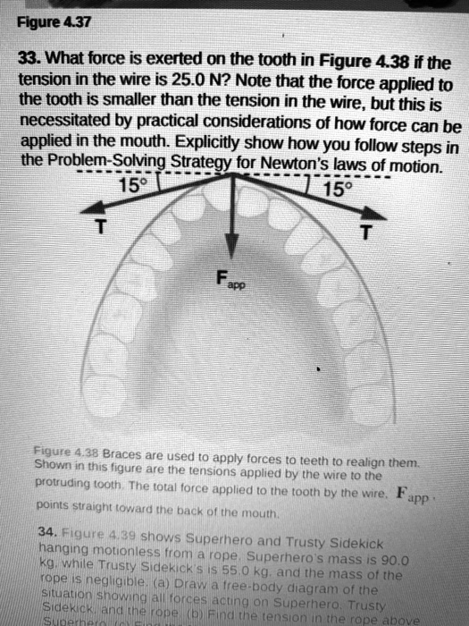 SOLVED: Figure 437 33. What force is exerted on the tooth in Figure 4. ...
