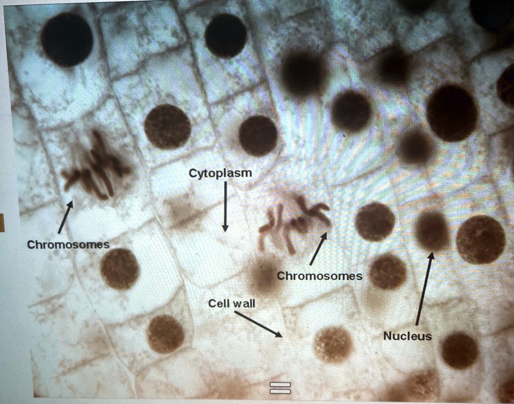 Cytoplasm Chromosomes Chromosomes Cell wall Nucleus