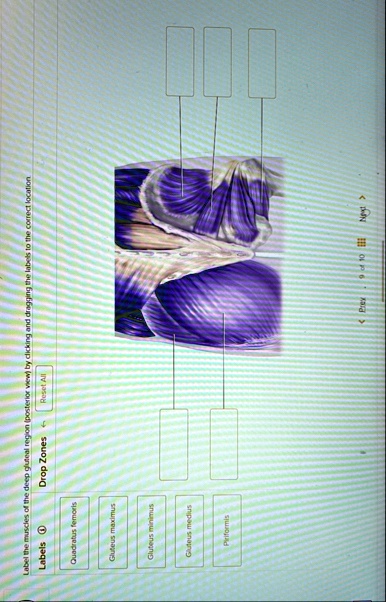Label the muscles of the deep gluteal region posterior view...