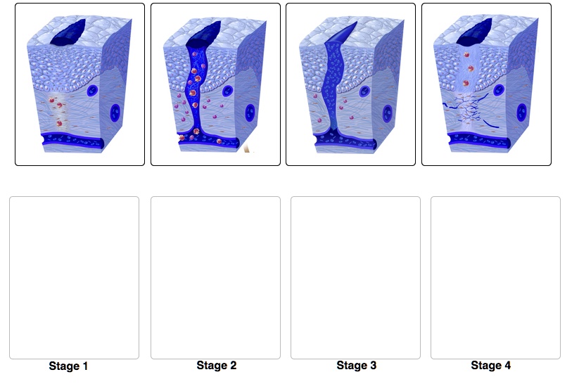 Stage 1 Stage 2 Stage 3 Stage 4