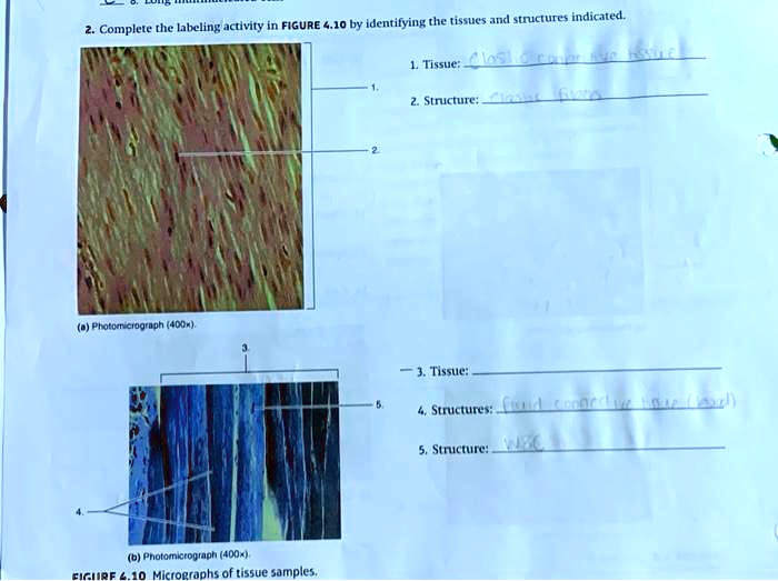 2. Complete the labeling activity in FIGURE 4.10 by identifying the tissues and structures ...