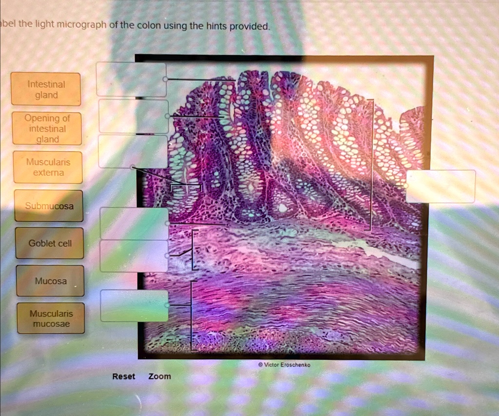 abel the light micrograph of the colon using the hints provided ...