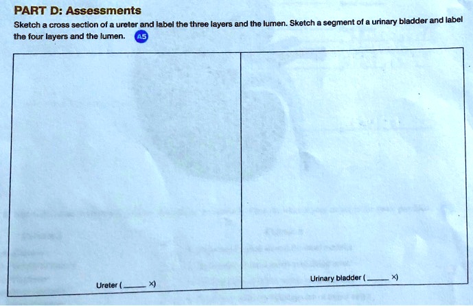 PART D: Assessments Sketch a cross section of a ureter and...