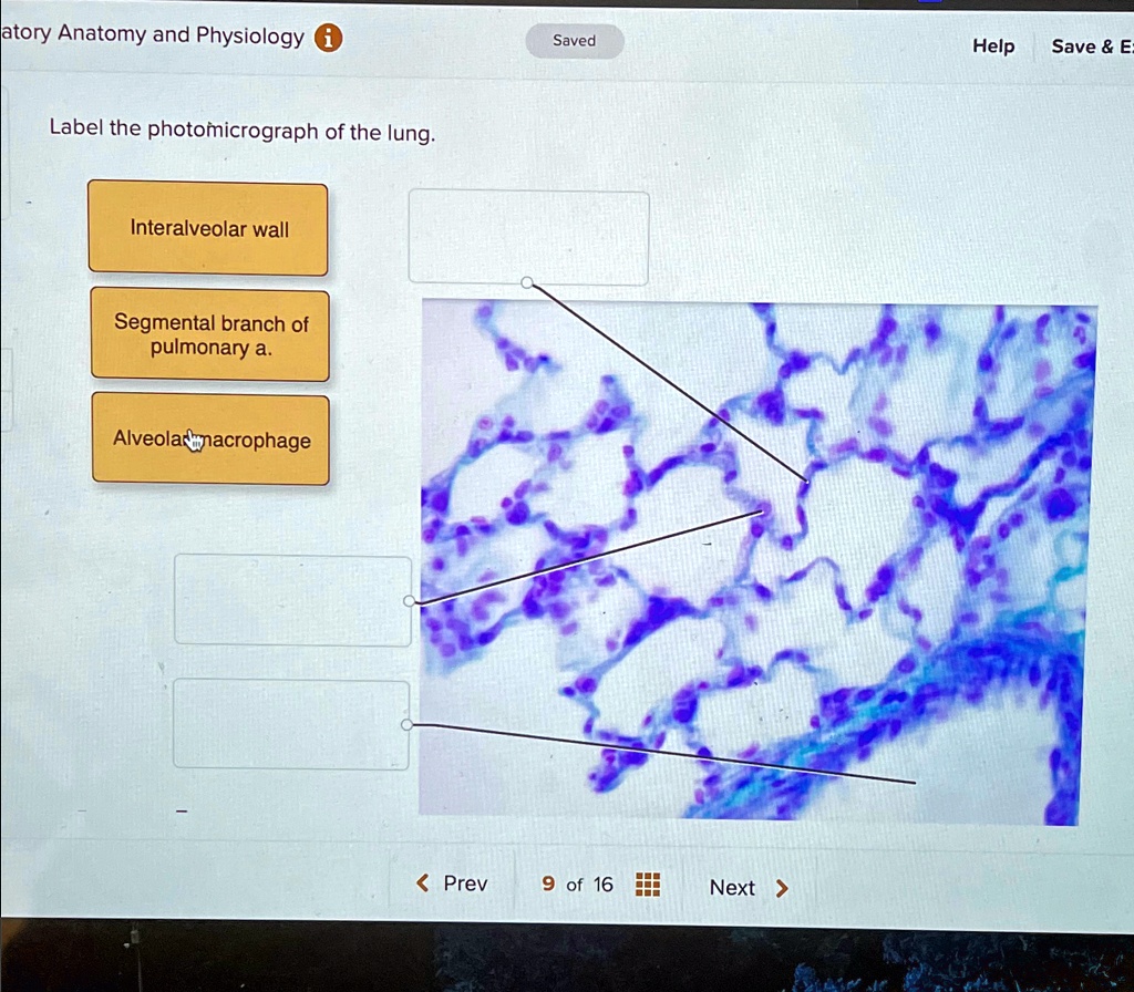 Anatomy and Physiology Label the photomicrograph of the lung ...