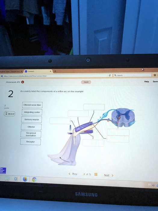 Homework #12 2 Accurately label the components of a reflex arc on this ...