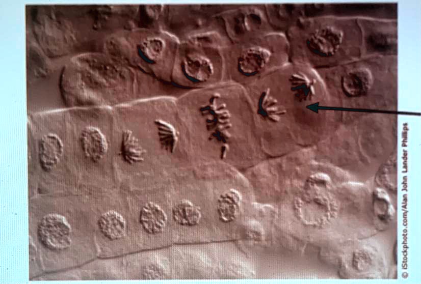 A photomicrograph of onion root tip cells during mitosis is shown below ...
