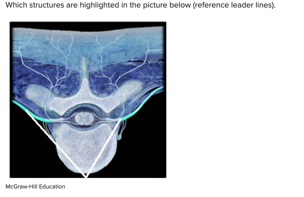 Which structures are highlighted in the picture below (reference leader ...