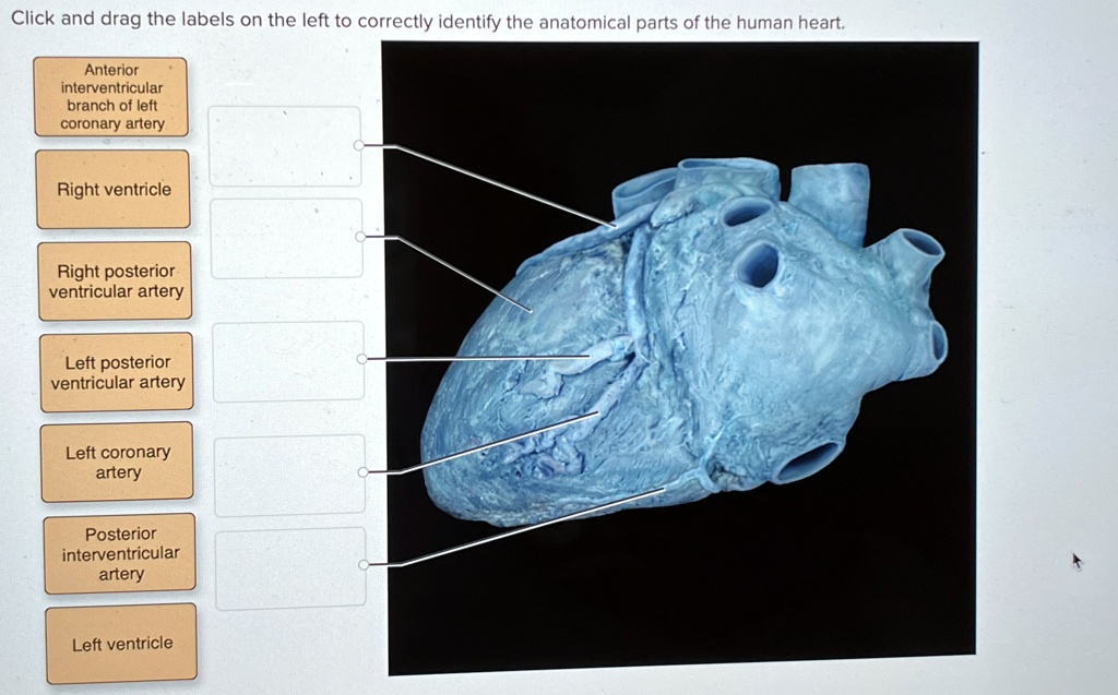click and drag the labels on the left to correctly identify the ...