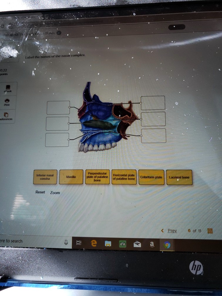 Label the bones of the nasal complex: - Inferior nasal concha - Maxilla ...